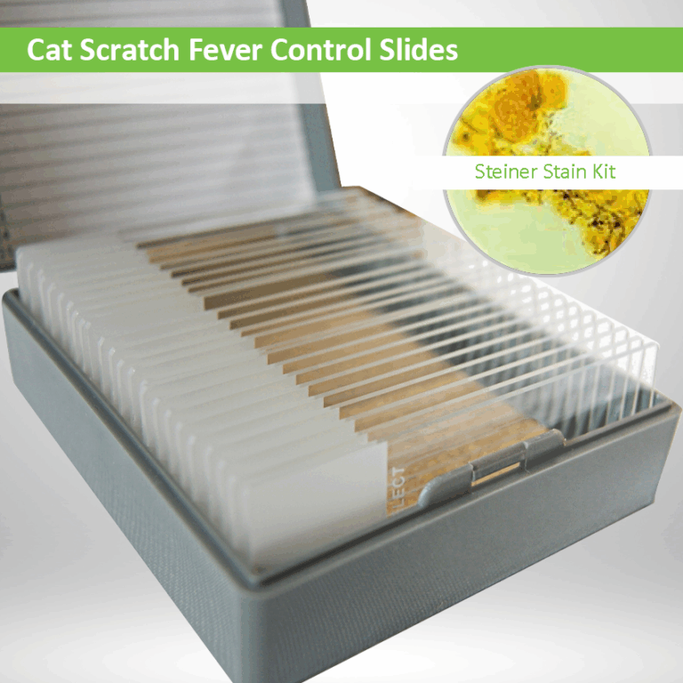 Cat Scratch Fever Control Slides - IMEB Inc.